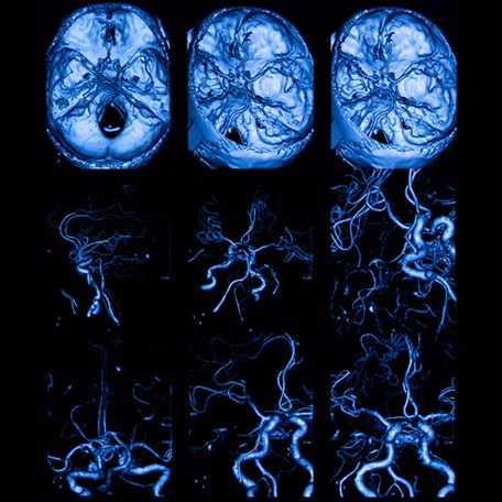 Department of Neurosurgery Research | Wake Forest University School of ...